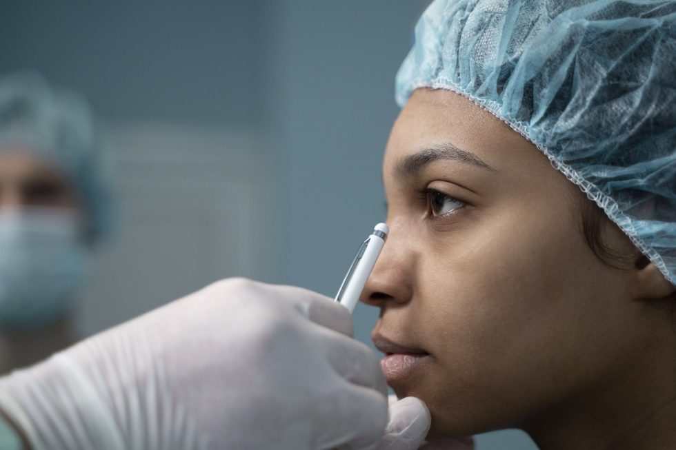 Profhilo Nasolabial Folds: Perfecting Facial Symmetry